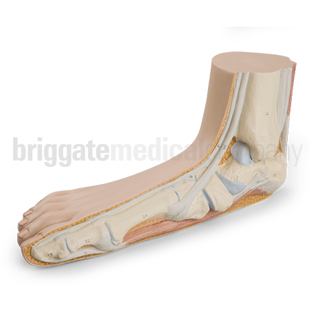 Foot Model - Anatomical Flat Foot - Briggate Medical Company