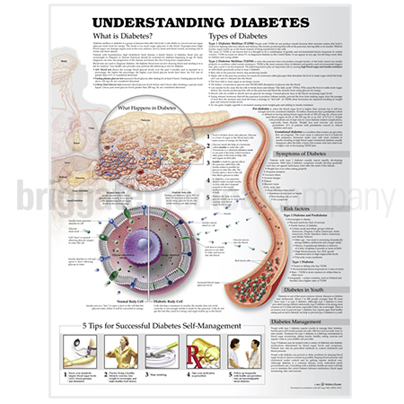 Laminated Chart - Understanding Diabetes - Briggate Medical Company