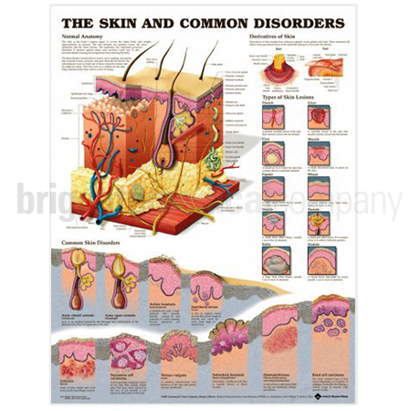 Laminated Chart - The Skin and Common Disorders - Briggate Medical Company